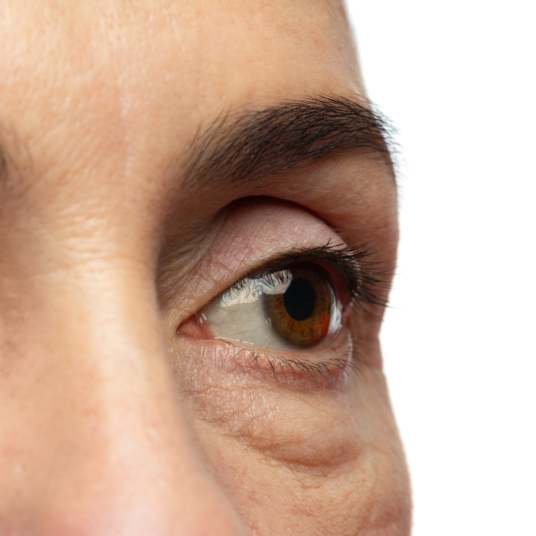 From Tired to Vibrant: Quick Fixes for Eye Bags - Revix Clinic